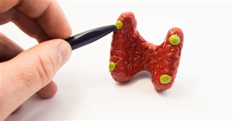The Treatment Of Hyperparathyroidism Why Surgery Is The Only Solution