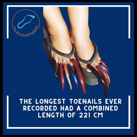 The Woodvale Podiatrist 👣 Friday Foot Fact The Longest Toenails Ever