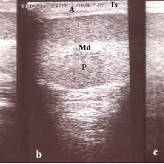 Longitudinal A And Transverse B Sectional Ultrasonographs Of The Download Scientific
