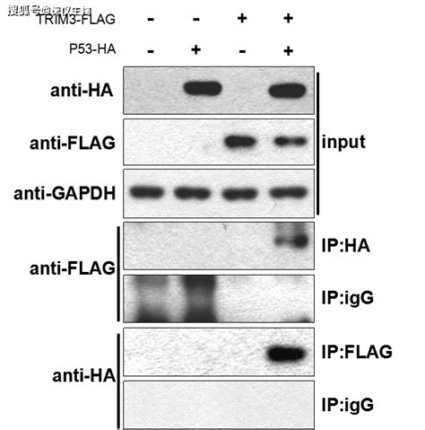 蛋白互作 免疫共沉淀Co Immunoprecipitation Co IP实验原理介绍 复合物 进行 抗体