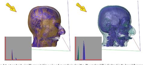 Figure 2 From Volume Visualization And Exploration Through Flexible