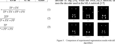 Figure 1 From Research On Focal Segmentation Of Bone Scan Based On Swin Transformer Semantic