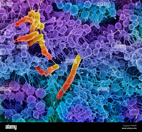 Oral Bacteria Coloured Scanning Electron Micrograph Sem Of Mixed Oral Bacteria Streptococcus