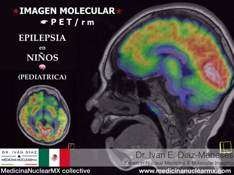 Nuclearmedicine Molecularimaging Theranostics Radionuclidetherapy Ivan E Diaz Meneses