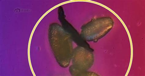 에어컨 세균 주의보 미세먼지 1000배 확대해보니경악