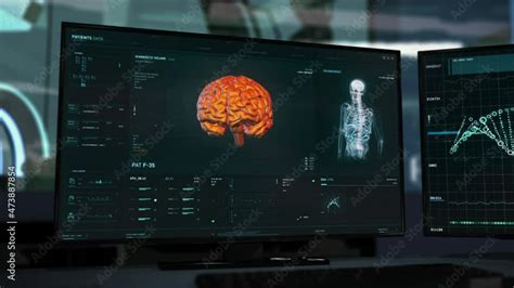 Monitoring Of The Patients Health At The Modern Hospital Monitoring Of The Brain Analysis
