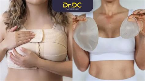 Breast Augmentation And Implants Know The Difference