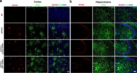 Reactive Astrocytes Surround Aβ Plaques In The Brain Of App Ps1 Mice