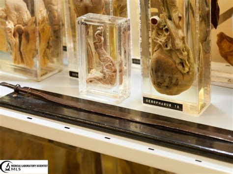 Fixation Ideal Fixative Factors Involved In Fixation Medical Laboratory Scientist Mls