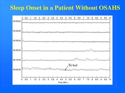 Ppt Using Holter Ecg And Heart Rate Variability To Detect Sleep Disordered Breathing