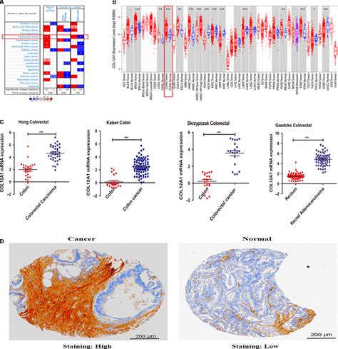 The Expression Of Col12a1 In Crc Analysis In Gepia A And Oncomine Download Scientific