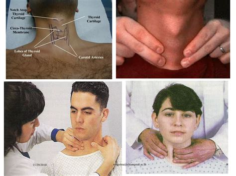 2010thyroid Examination Pdf