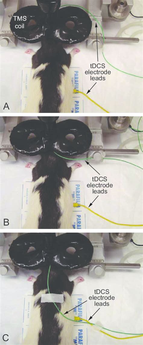 Setup For Simultaneous TMS TDCS In Rat With Three Different TDCS Download Scientific Diagram