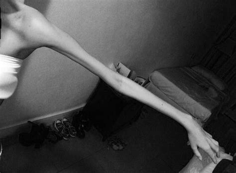 Skinny Arm Thinspo