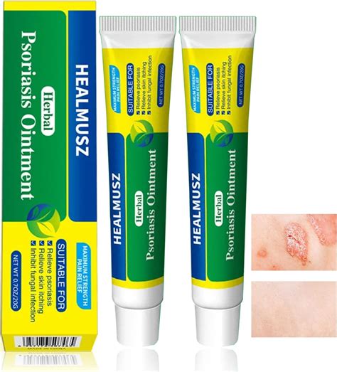 Psoriasis Ointment Psoriasis Cream And Eczema Cream Psoriasis Soothing