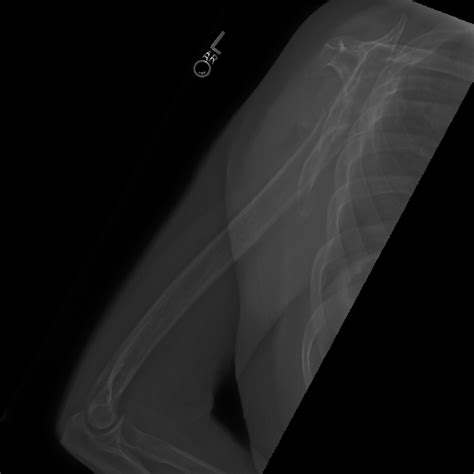 Thesis Object Detection Dataset By New Workspace Uypfa