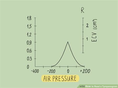 How To Read And Interpret Normal And Abnormal Tympanogram Results