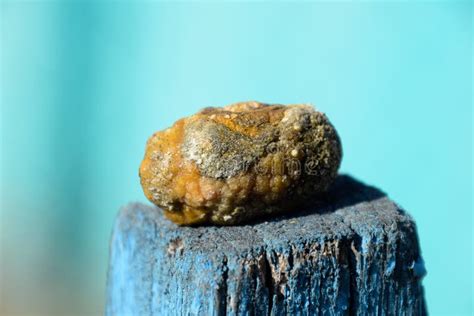 385 Piedra De Vejiga Fotos Libres De Derechos Y Gratuitas De Dreamstime