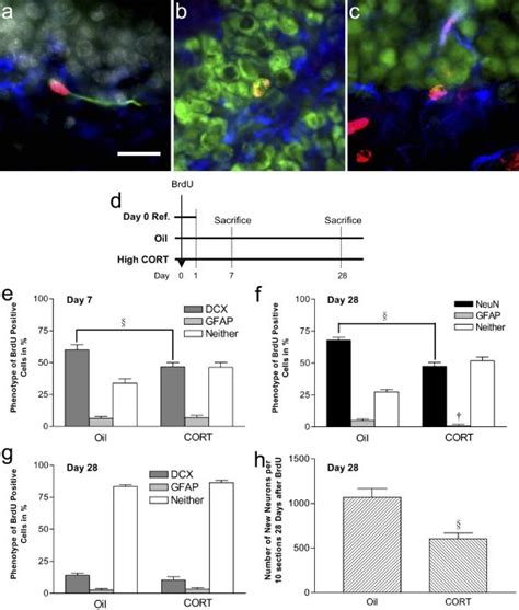 The Morphology Of A A Brdu Dcx Double Positive Cell B A Brdu Neun
