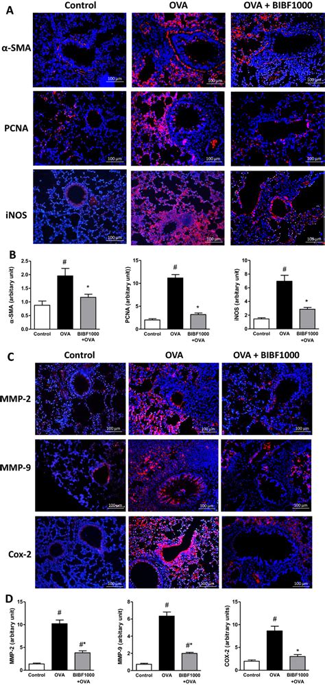 Lung Tissue Expressions Of α Sma Pcna Inos Mmp 2 Mmp 9 And Cox 2 Download Scientific