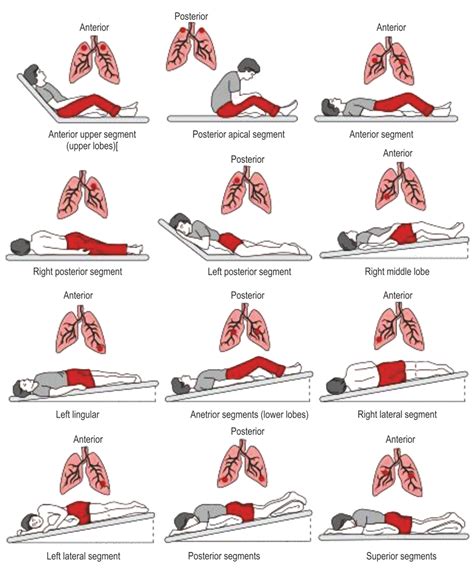 Postural Drainage Saans Foundation