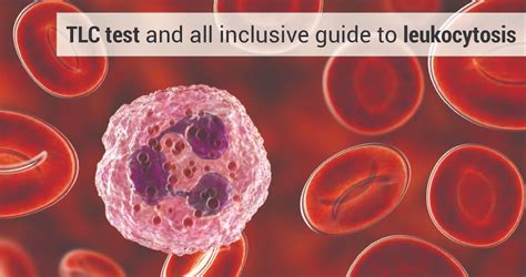 Tlc Test And All Inclusive Guide To Leukocytosis Manipal Trutest