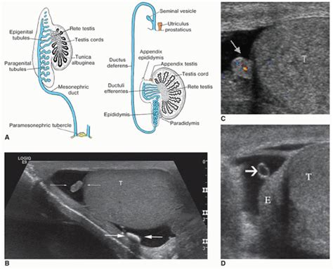 The Scrotum And Penis Radiology Key