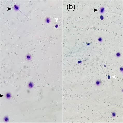 Sperm DNA Fragmentation In Samples Processed By Microfluidic Sperm Download Scientific Diagram