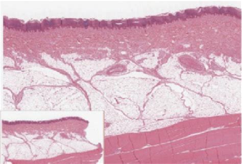 Epidermis Structure Under Microscope Layers And Functions Of Skins Outer Layer Anatomy Note