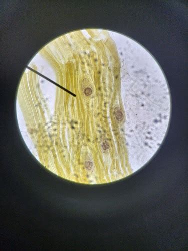 Nematodes Flashcards Quizlet