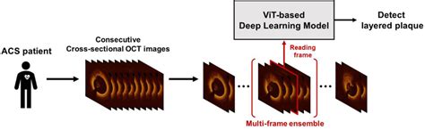 Vision Transformer Vit Based Deep Learning Model For Diagnosis Of