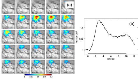 Figure 5 From Laser Speckle Contrast Imaging In Biomedical Optics Semantic Scholar