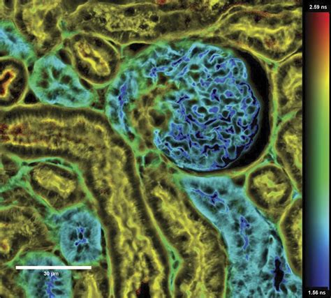 Fluorescence Lifetime Imaging Microscopy Provides Molecular Insights In
