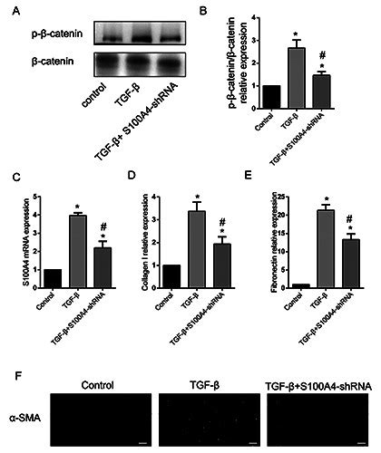 Downregulation Of S100 Calcium Binding A4 S100a4 Ameliorates Hepatic