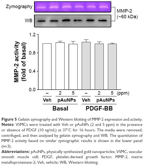 Naked Physically Synthesized Gold Nanoparticles Affect Migration Mito