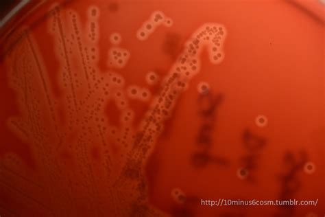 Microcosm Streptococcus Iniae Part 2 Identification