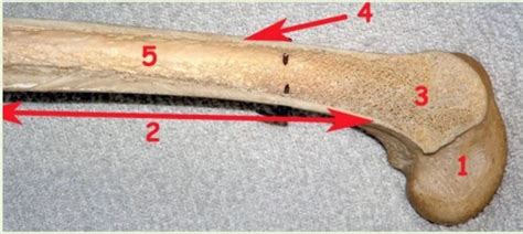 split femur model diagram quizlet