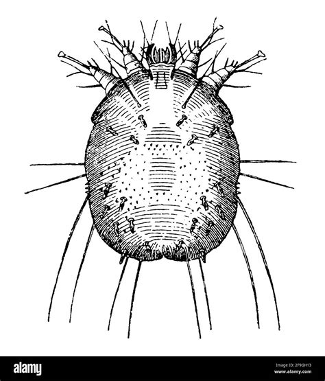 Sarcoptes Scabiei In Humans