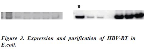 Active Recombinant Reverse Transcriptase Domain Of Human Hepatitis B Virus Polymerase