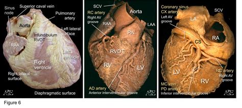 Images Cardiac Anatomy For Electrophysiologist