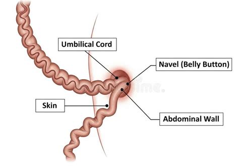Diagram Showing Anatomical Elements Of The Umbilical Cord Stock