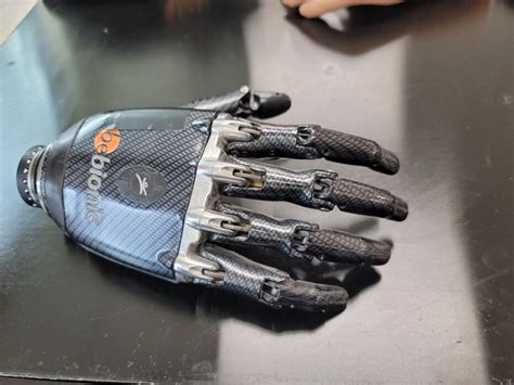 Myoelectric Prostheses — Within Reach