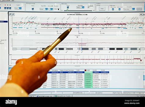 Analysis Of 105 000 Pieces Of Human Dna Prenatal Diagnosis Using Array Cgh Comparative Genomic