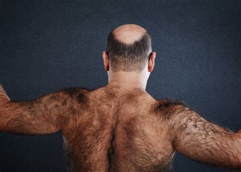 370 Costas Do Homem Bald Head Fotos De Stock Imagens E Fotos Royalty