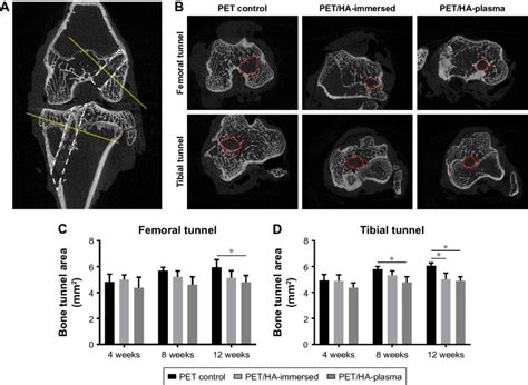 Micro Ct Analysis Of Tibial And Femoral Bone Tunnel Size Notes A Download Scientific