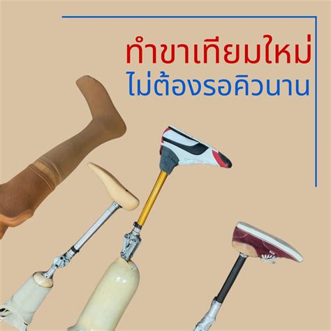 🎉 สวัสดีค่ะ มีข่าวดีมาบอกจากโรงพยาบาลบางกรวย ที่นี่คุณสามารถทำขาเทียมใหม่หรือซ่อมบำรุงได้ โดย