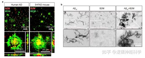Nat Neurosci︱革新！厦门大学王鑫课题组发现阿尔茨海默病治疗新靶点 知乎