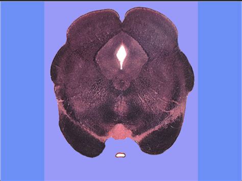 Midbrain Important Structures Both Cn And Descending Tracts Diagram Quizlet