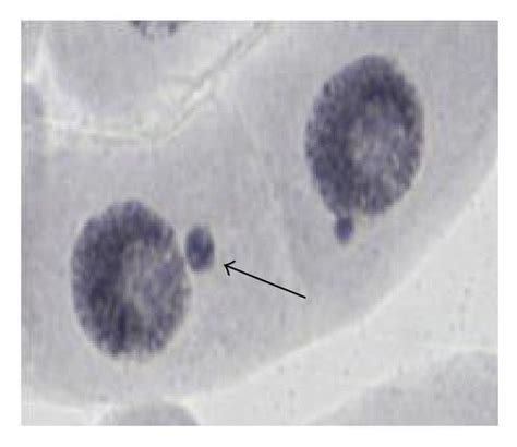 Chromosomal Aberrations And Nuclear Irregularities Observed In Root Tip