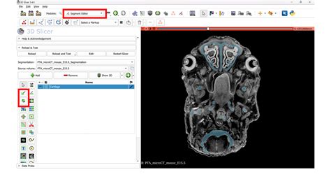 Github Sperrine3dslicersegmentationtutorial
